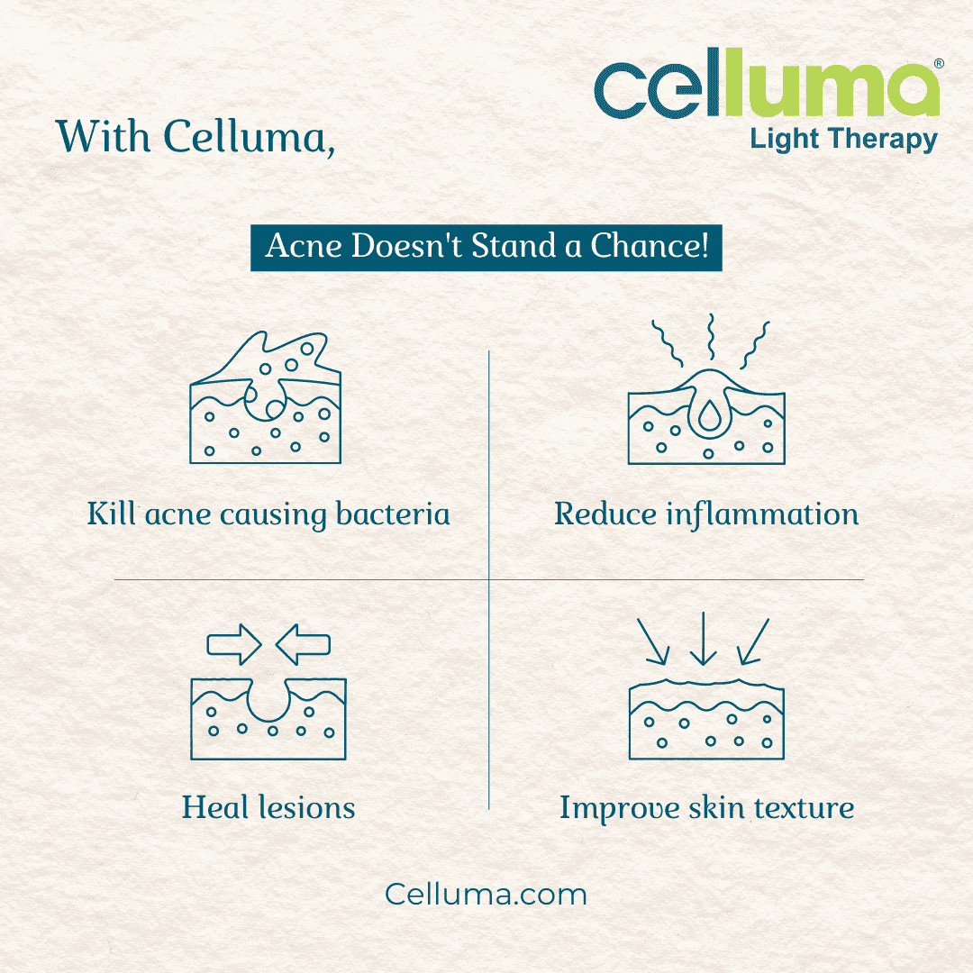 Effective Acne Treatments: Banishing Breakouts | Estie Co!