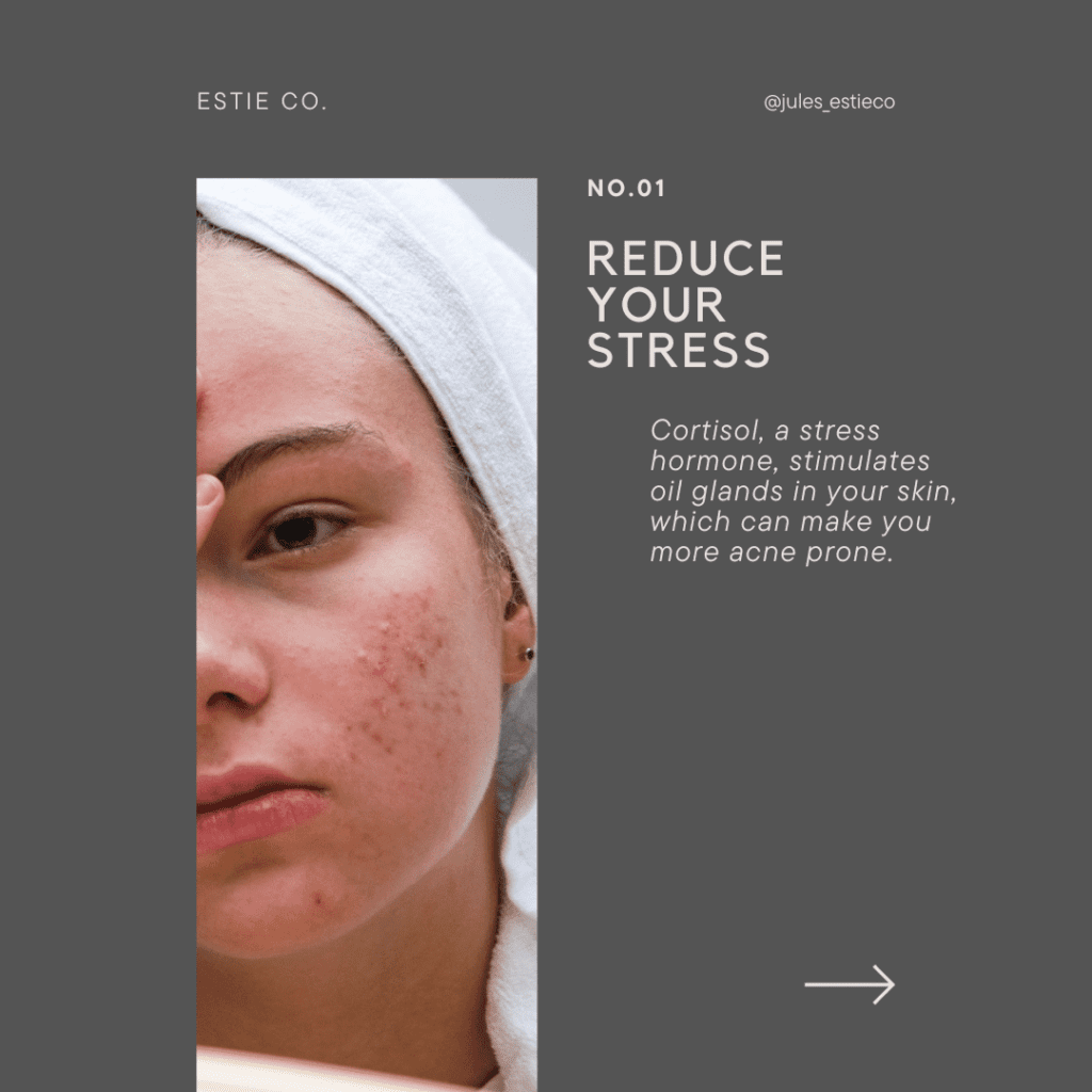 7 Tips To Avoid Breakouts And Achieve Healthy Skin | Estie Co!